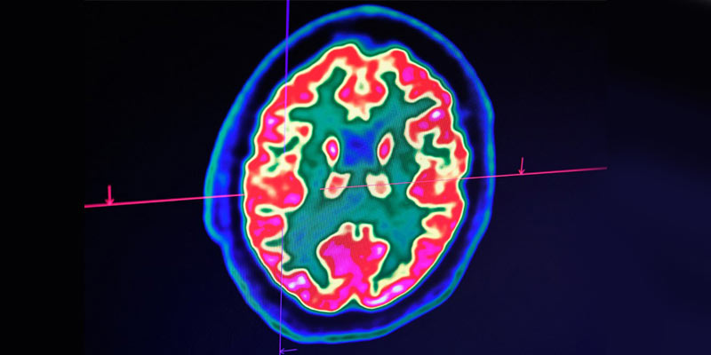 What is DBT-NBRC’s SWADESH project? | biotechnology | Alzheimer’s ...